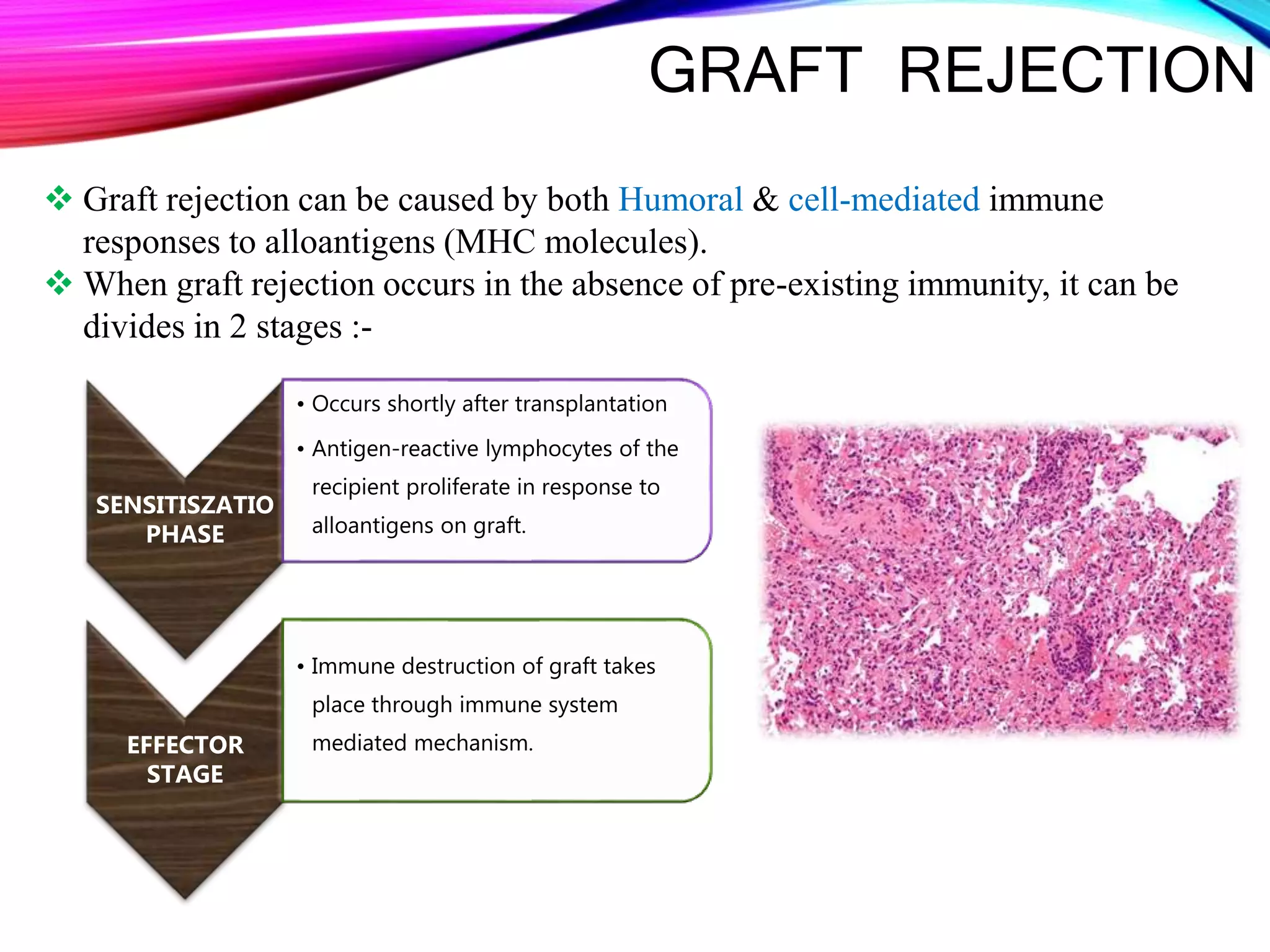Transplantation | PPTX