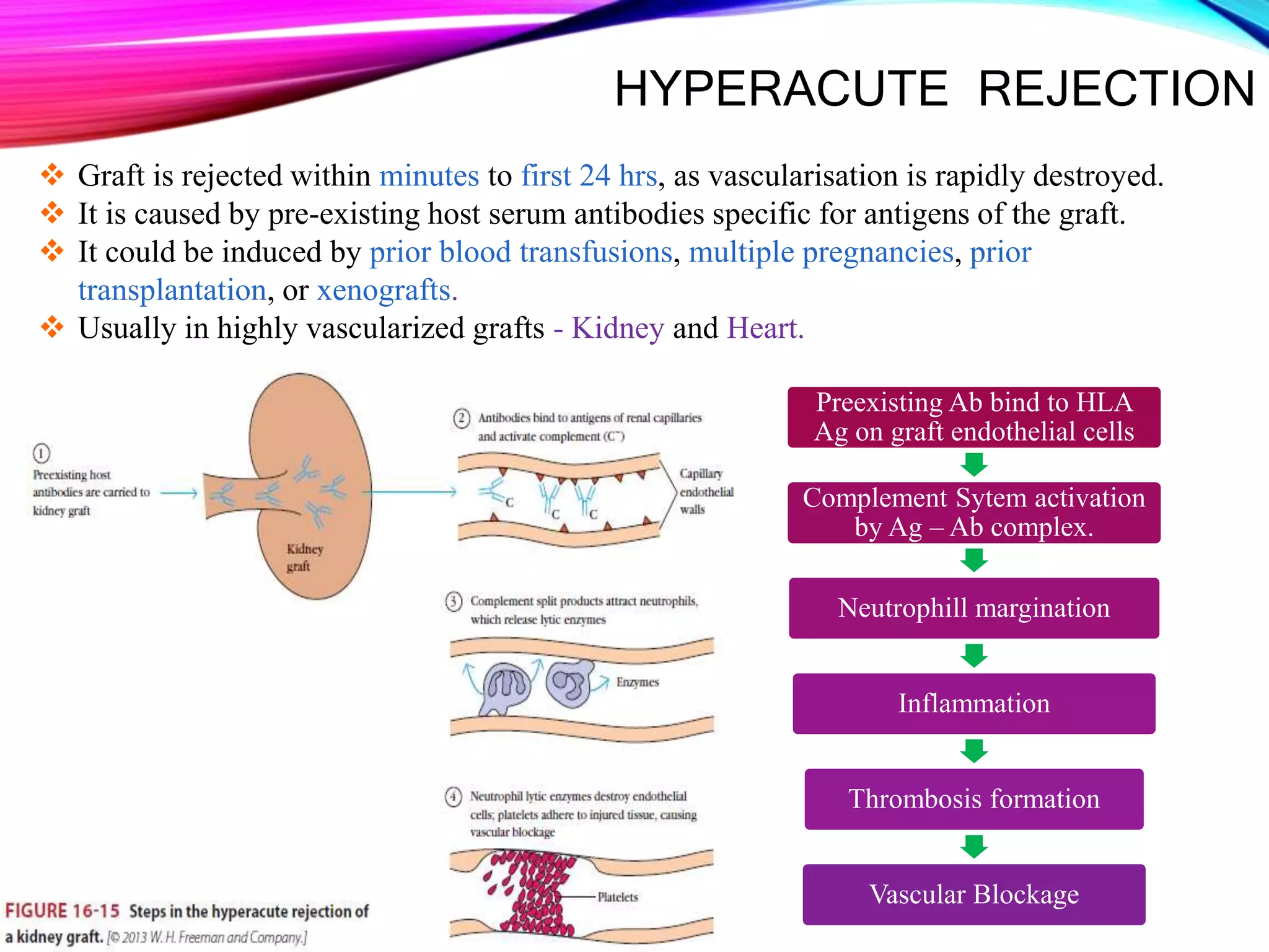 Transplantation | PPTX