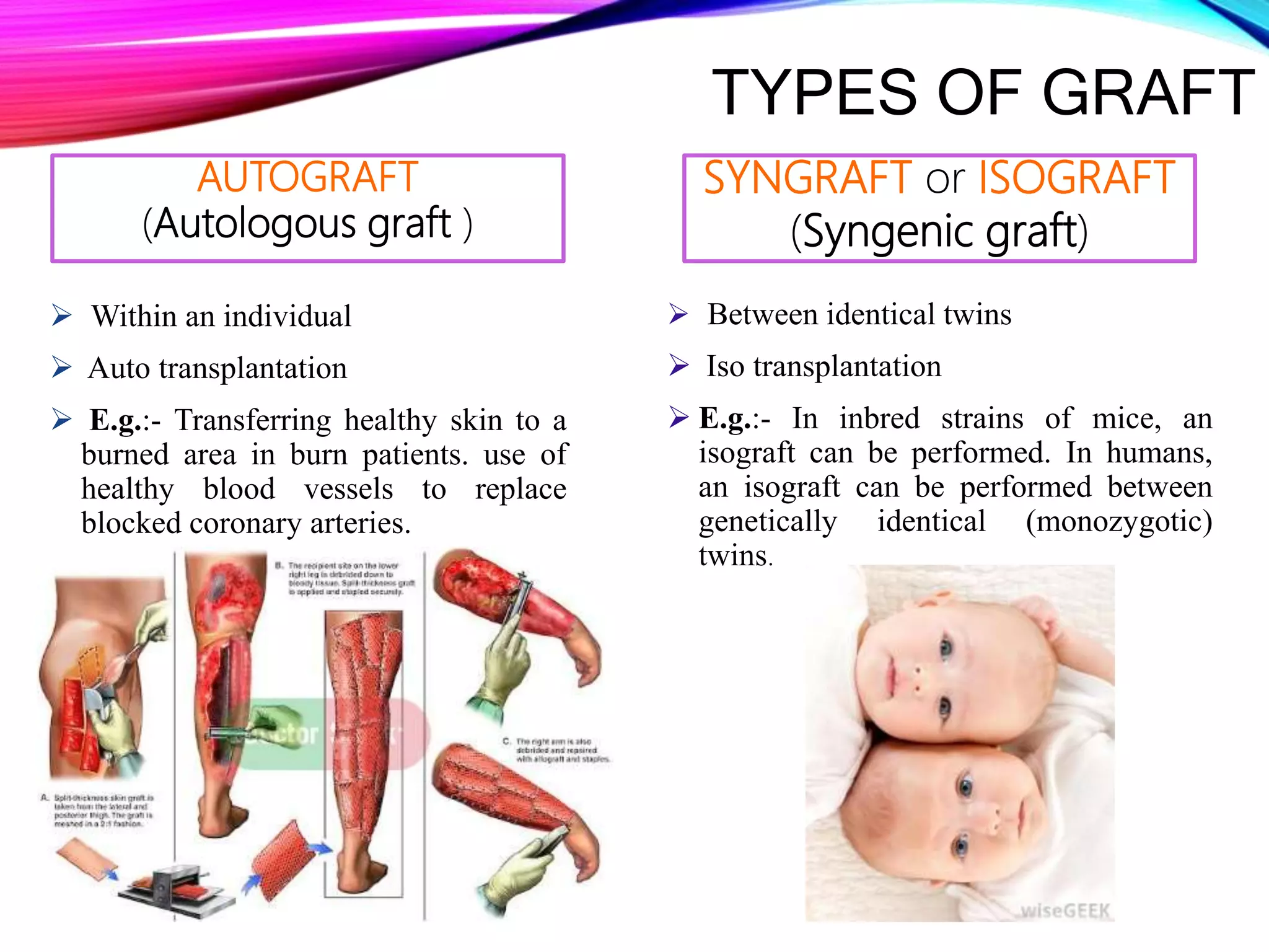 Transplantation | PPTX