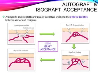 Transplantation | PPTX