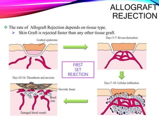 Transplantation | PPTX