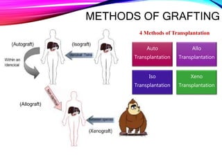Transplantation | PPTX