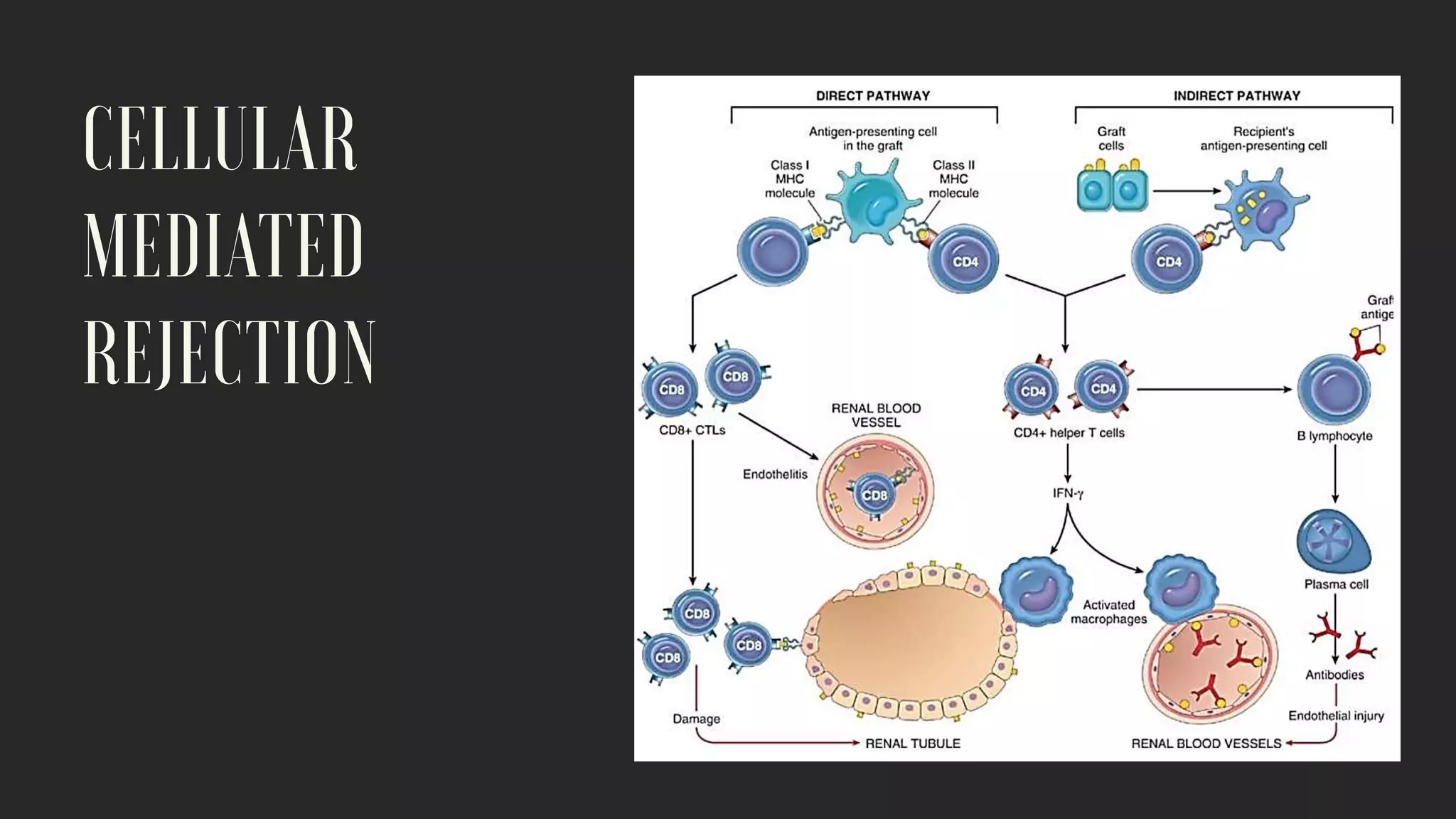 Transplantation Rejection.pptx