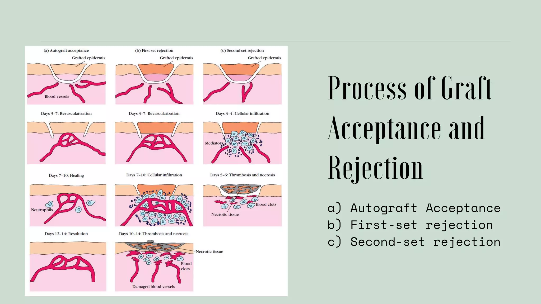 Transplantation Rejection.pptx