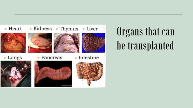 Transplantation Rejection.pptx