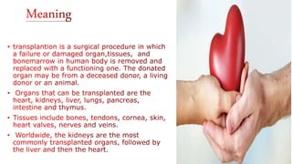 Transplantation services | PPT