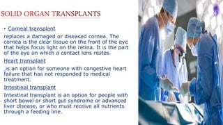 Transplantation services | PPT