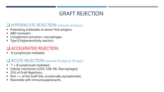 Transplantation Surgery | PPTX