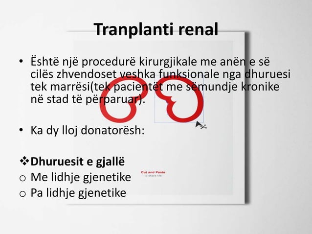 Transplanti i veshkes | PPTX