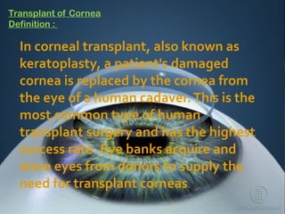 Transplant of cornea | PPT