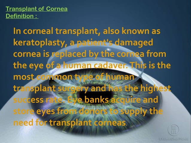Transplant of cornea | PPT