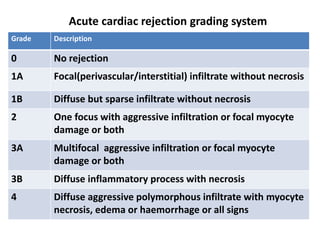 Transplant pathology | PPT