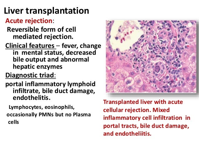 Transplant pathology