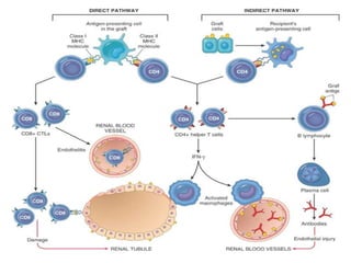 Transplant rejection | PPTX