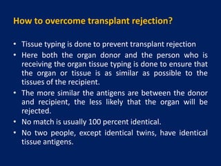 Transplant rejection | PPTX