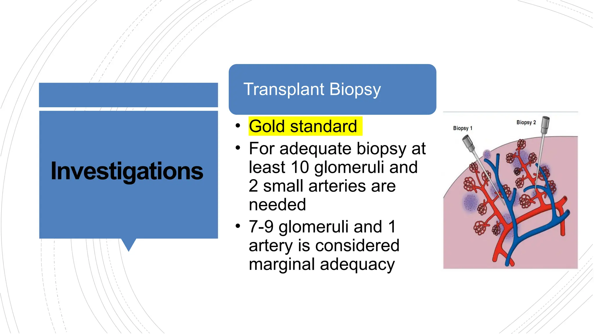 Transplant Rejection: from diagnosis to management.pptx