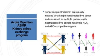 Transplant Rejection: from diagnosis to management.pptx