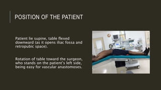 Renal Transplantation (Per-Operative) | PPTX