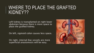 Renal Transplantation (Per-Operative) | PPTX