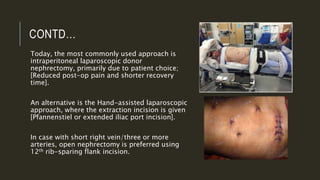 Renal Transplantation (Per-Operative) | PPTX