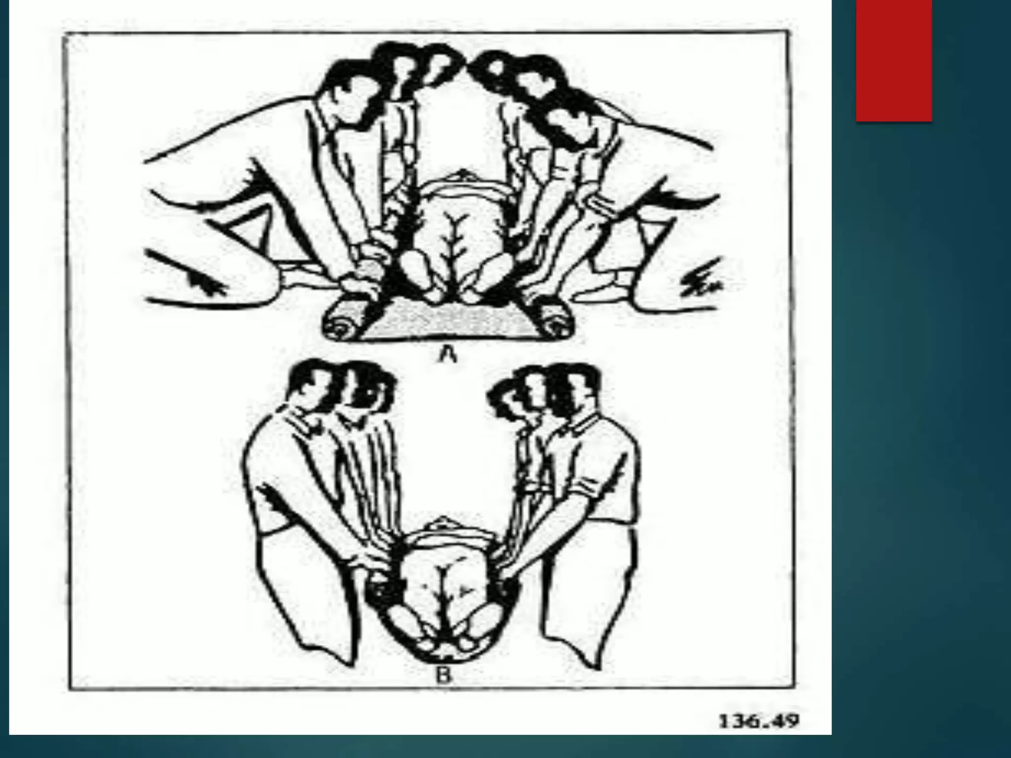 transporting the victim.pptx