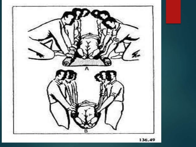 transporting the victim.pptx | First Aid | Injuries