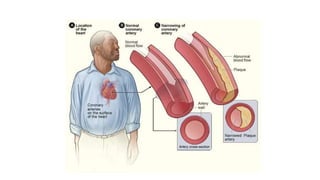 Transport in humans | PPTX | Heart and Cardiovascular Diseases ...