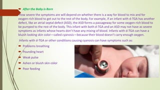 Transposition of Great Arteries(TGA) by Суд Ааруши.pptx