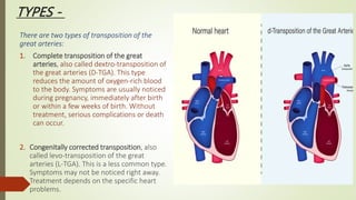 Transposition of Great Arteries(TGA) by Суд Ааруши.pptx