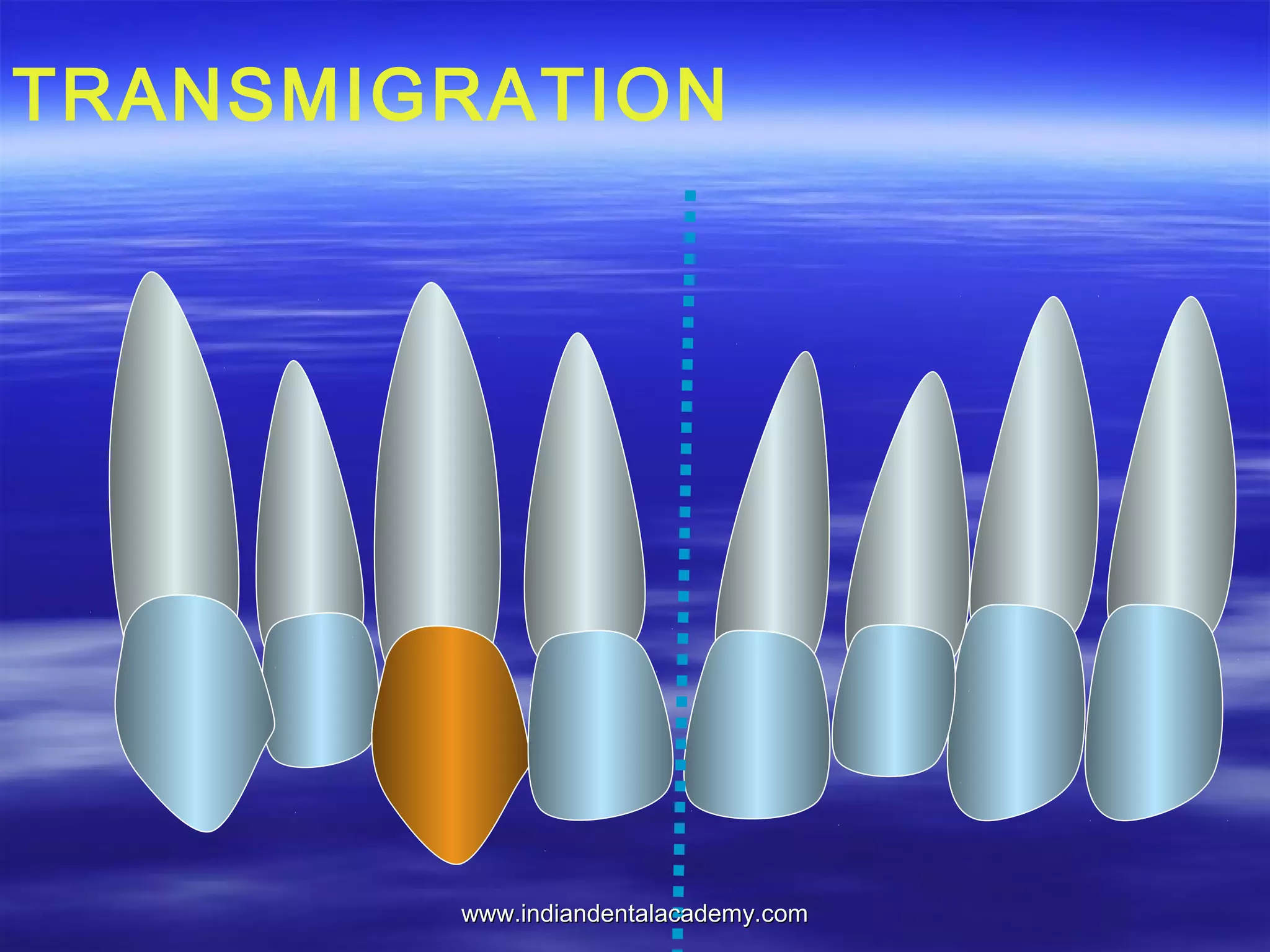 Transposition of teeth & its management | PPT | Dental Health ...