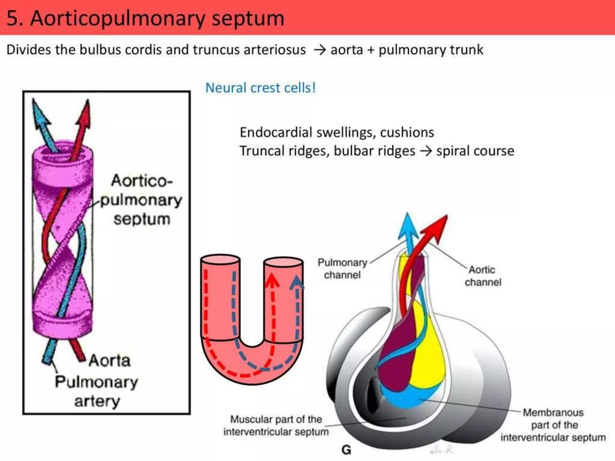 Transposition of the great arteries | PPT