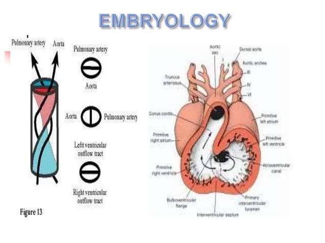 Transposition of the great arteries | PPT | Heart and Cardiovascular ...