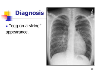 Transposition Egg On A String