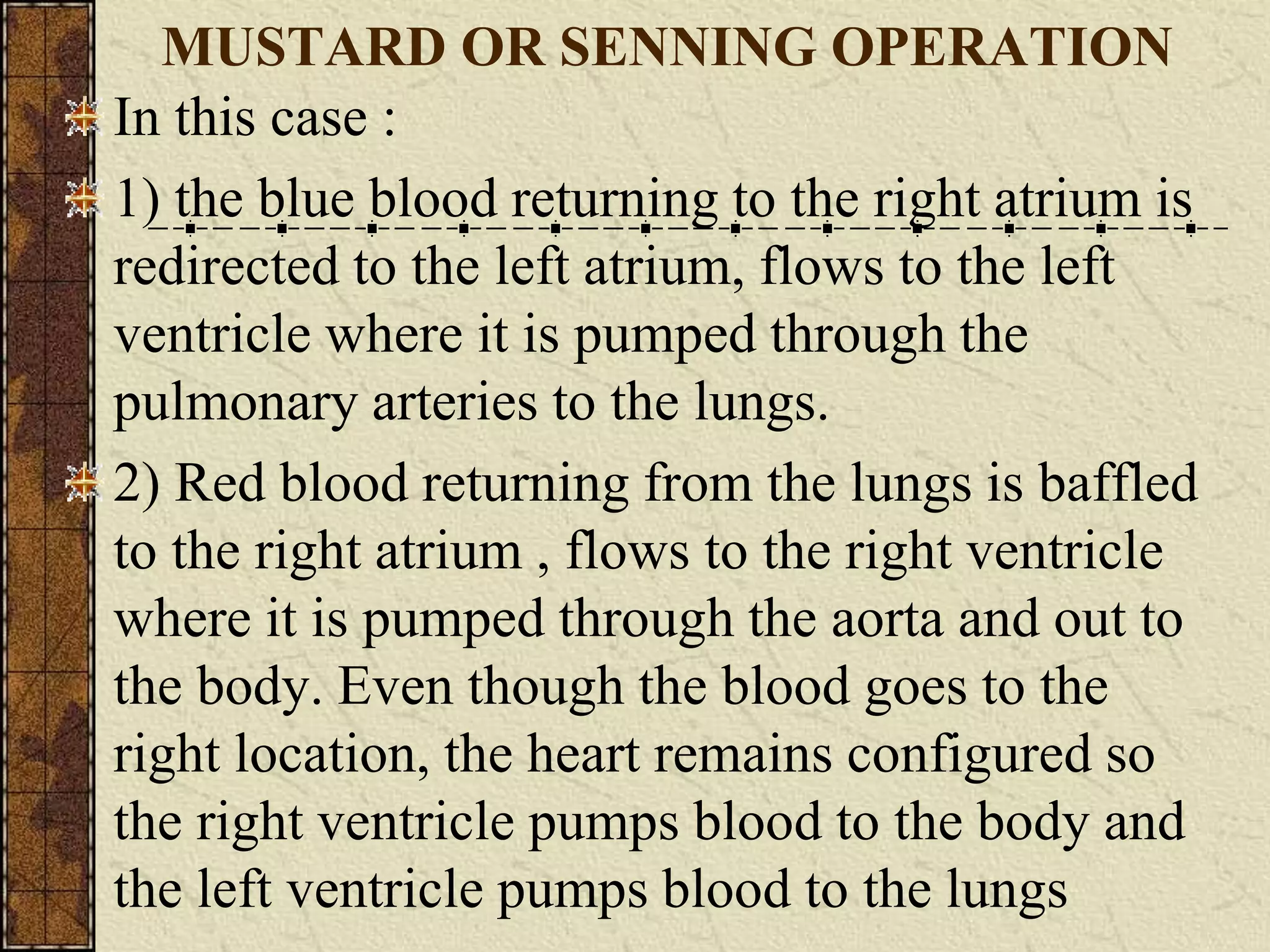 Transposition of the great arteries | PPT