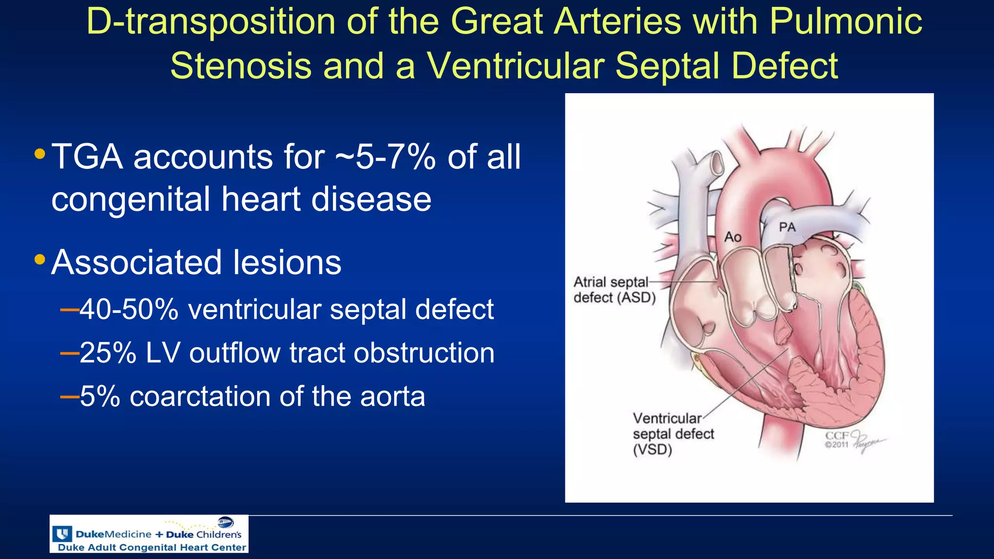 Pulmonary Hypertension in an Adult with Complex Congenital Heart ...