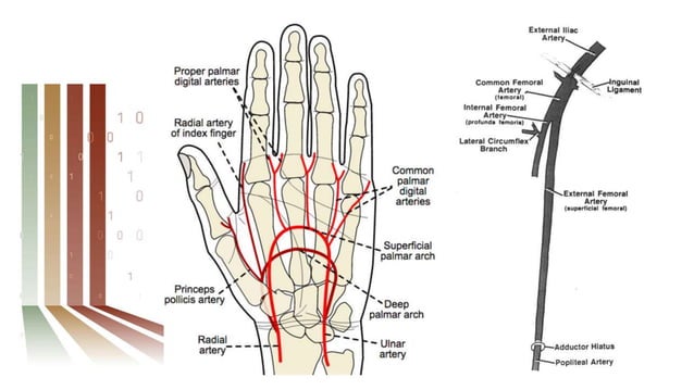 transradial approach for neurointerventions.pptx
