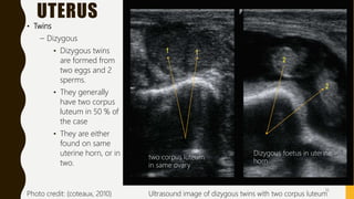 Transrectal ultrasonography in reproductive management of cattle | PPTX