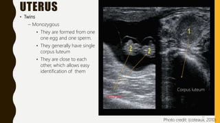 Transrectal ultrasonography in reproductive management of cattle | PPTX