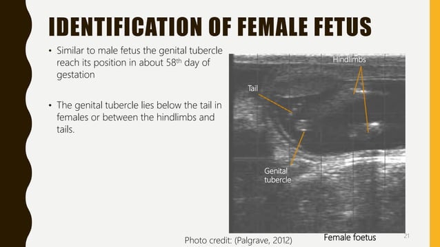 Transrectal ultrasonography in reproductive management of cattle | PPTX
