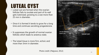 Transrectal ultrasonography in reproductive management of cattle | PPTX