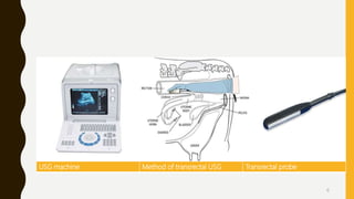 Transrectal ultrasonography in reproductive management of cattle | PPTX
