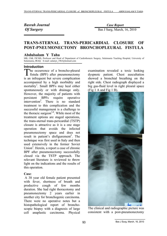 Trans sternal trans pericardial closure of post pneumonectomy ...