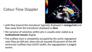 Transthoracic Echocardiogram, 3D, Doppler, TEE.pptx