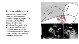 Transthoracic Echocardiogram, 3D, Doppler, TEE.pptx