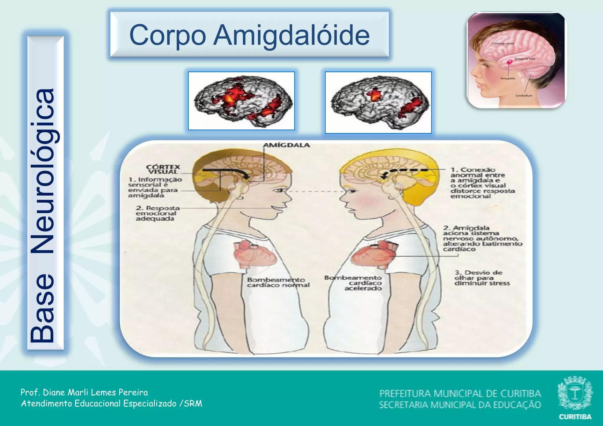 Transtorno do espectro do autismo prof. diane 2019 | PDF
