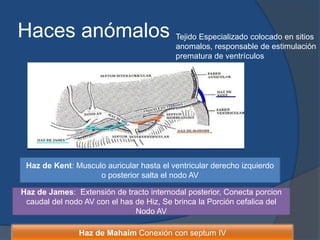 Transtornos de conduccion | PPTX
