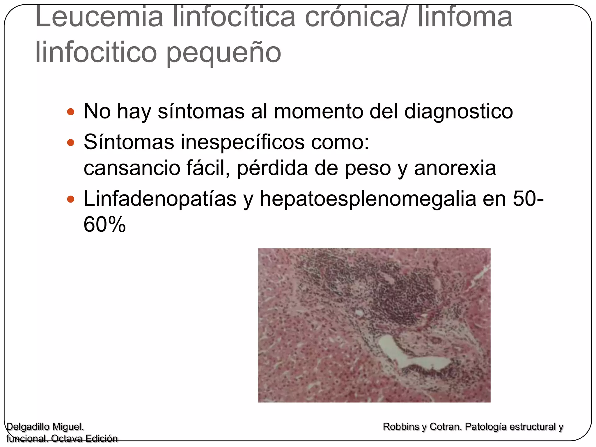 Enfermedades de los leucocitos, ganglios linfaticos, bazo y timo | PPTX