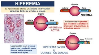 Transtornos Hemodinamicos 1.pdf