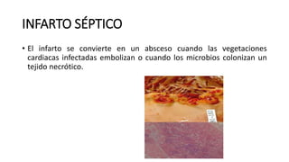 Transtornos hemodinamicos patologia | PPTX