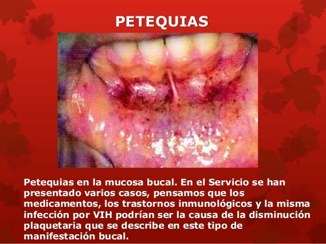 Transtornos Hemodinámicos, Trombosis y Shock
